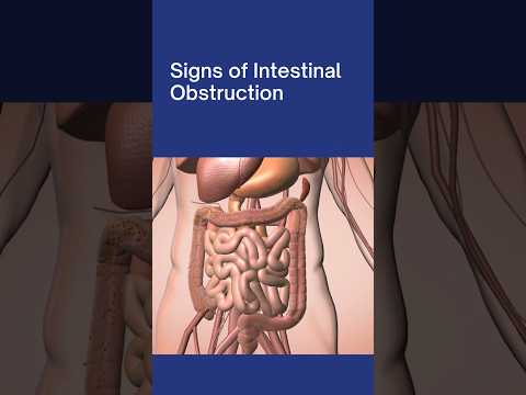 Signs of Intestinal Obstruction I Treatment for intestine obstruction in Delhi Noida