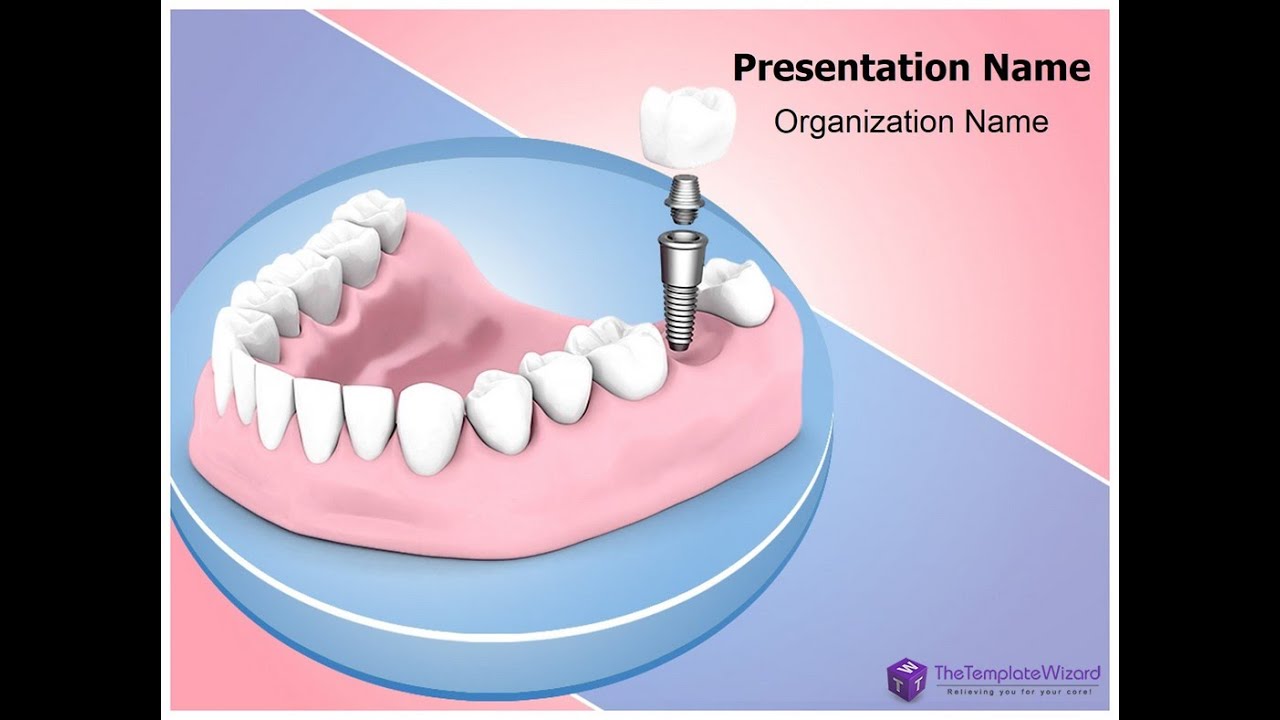 Dental Implant PowerPoint Presentation Template - TheTemplateWizard