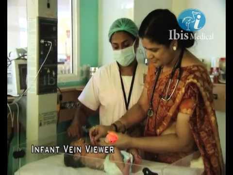 Vein Viewer - Vein Finder Latest Price, Manufacturers & Suppliers