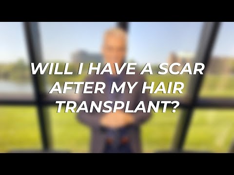 Will I Have A Scar After A Hair Transplant?