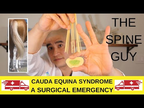 Cauda Equina Syndrome: A Surgical Emergency