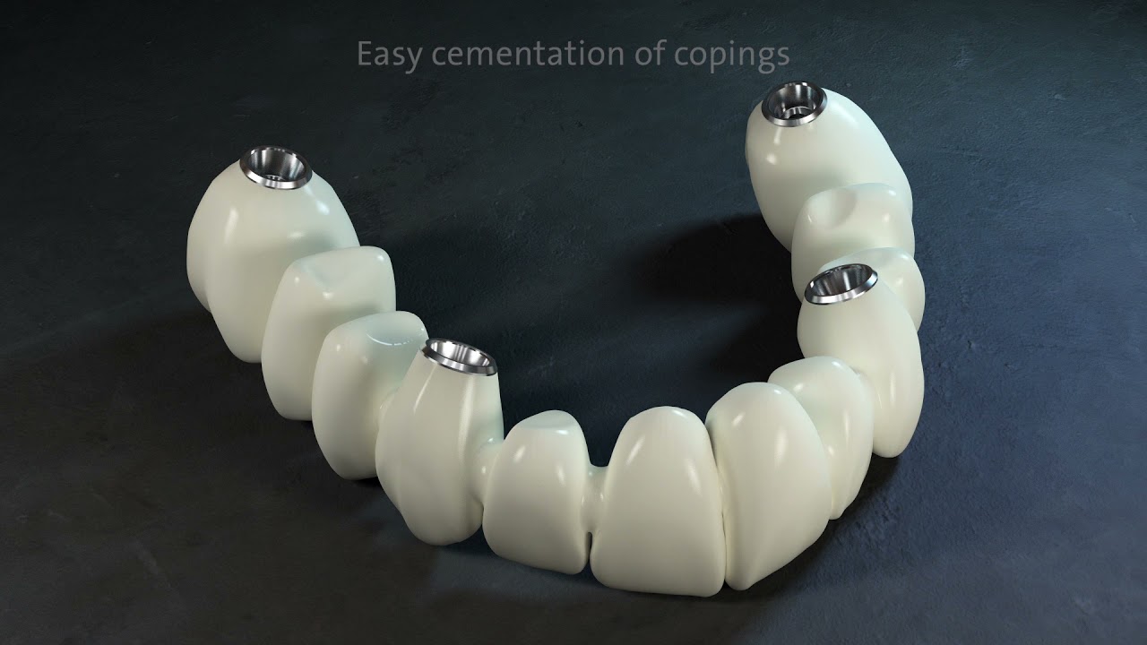 Straumann® Variobase® for full-arch restorations