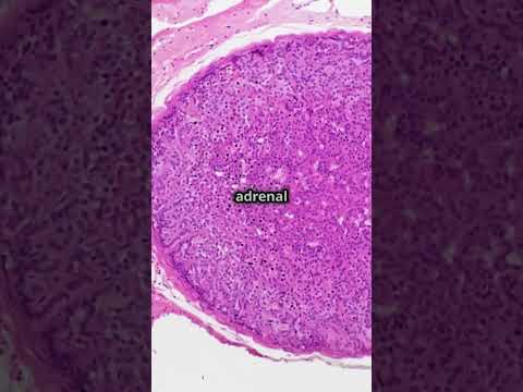 RAAS System Explained in 60 Seconds! | Quick Med Insights #medicalstudents
