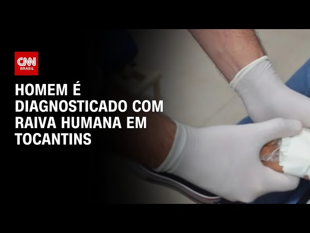 Homem é diagnosticado com raiva humana no Tocantins | CNN Brasil