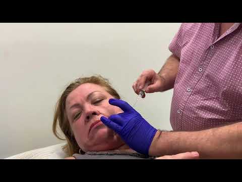 Lipolysis fat dissolving injection