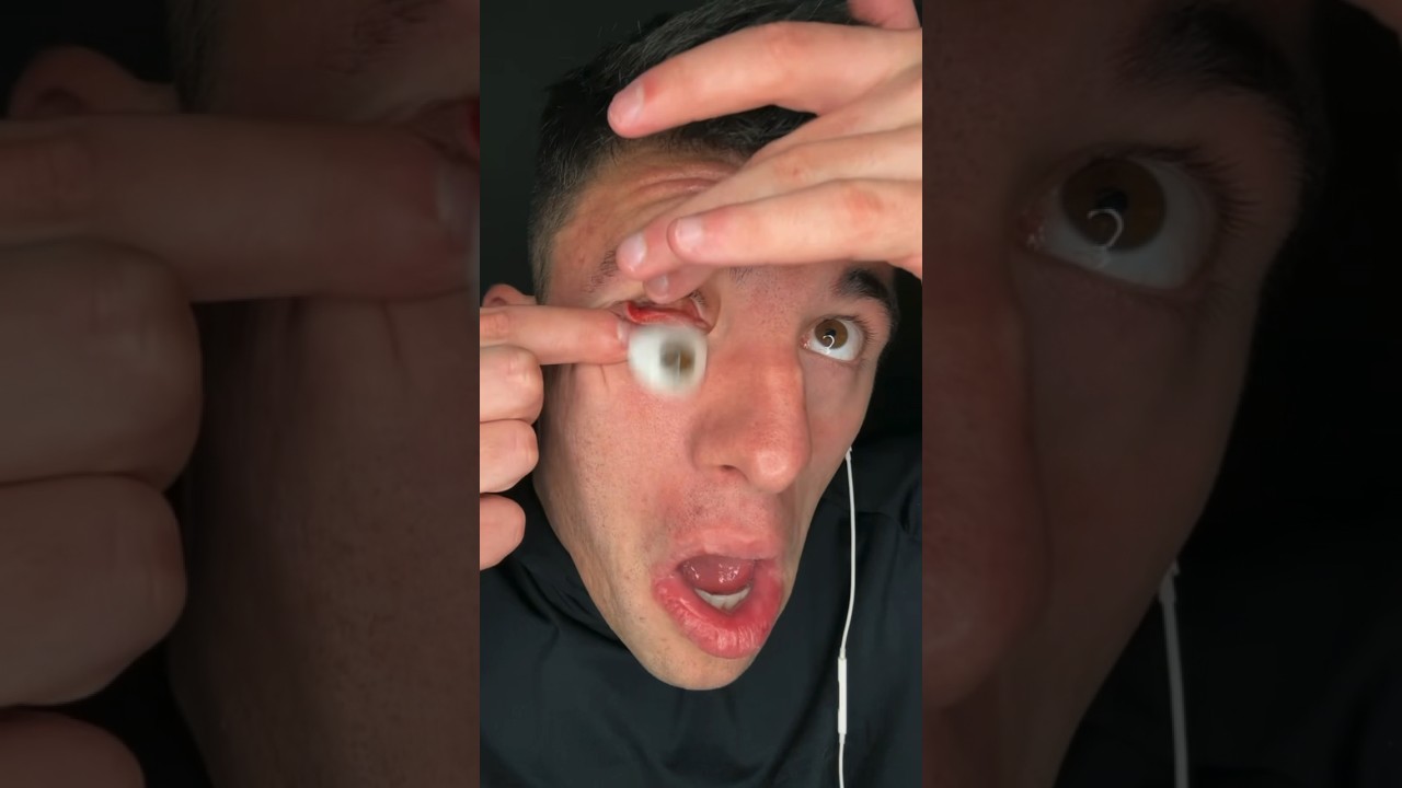 MY EYEBALL POPPED OUT 😳
