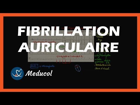 La Fibrillation Auriculaire: Définition et Symptômes