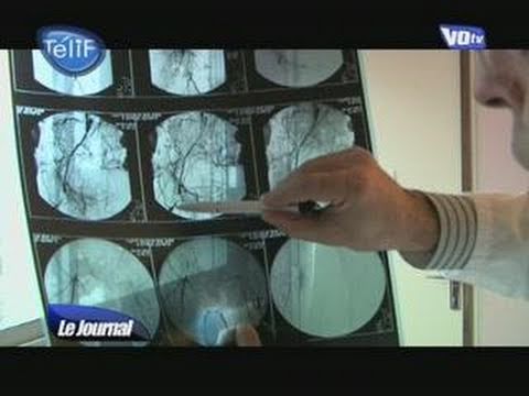 Artérite : dépistage gratuit à l'hôpital de Pontoise
