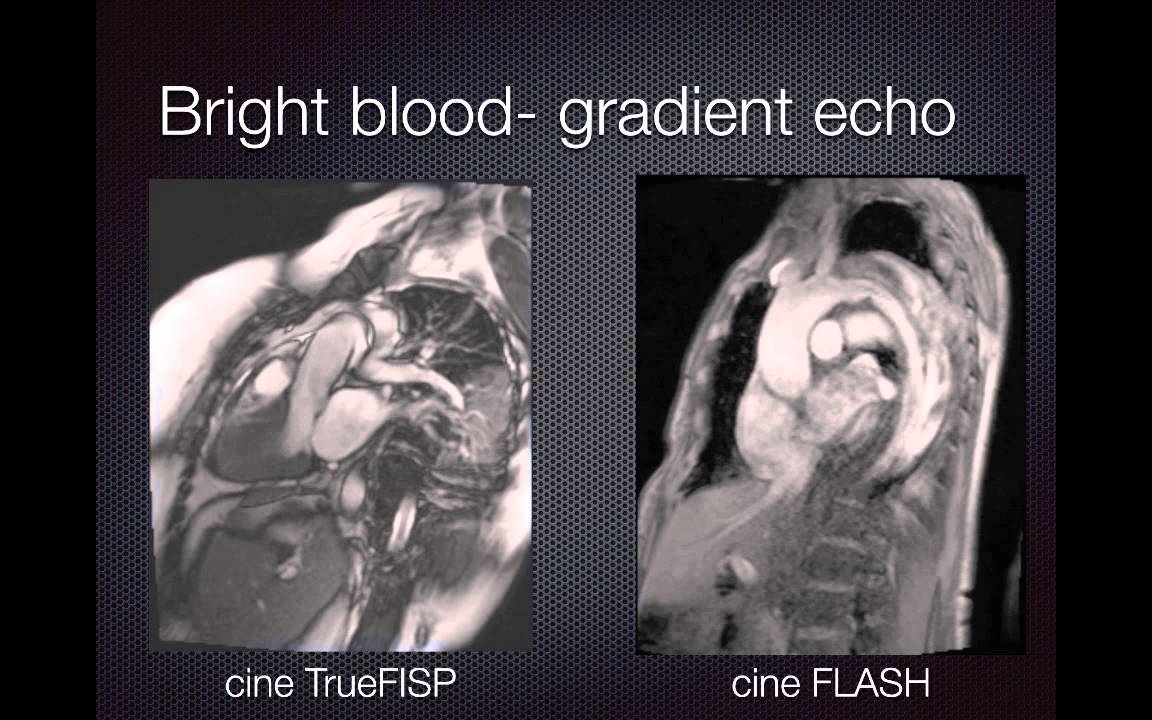 Cardiac MRI Pulse sequences