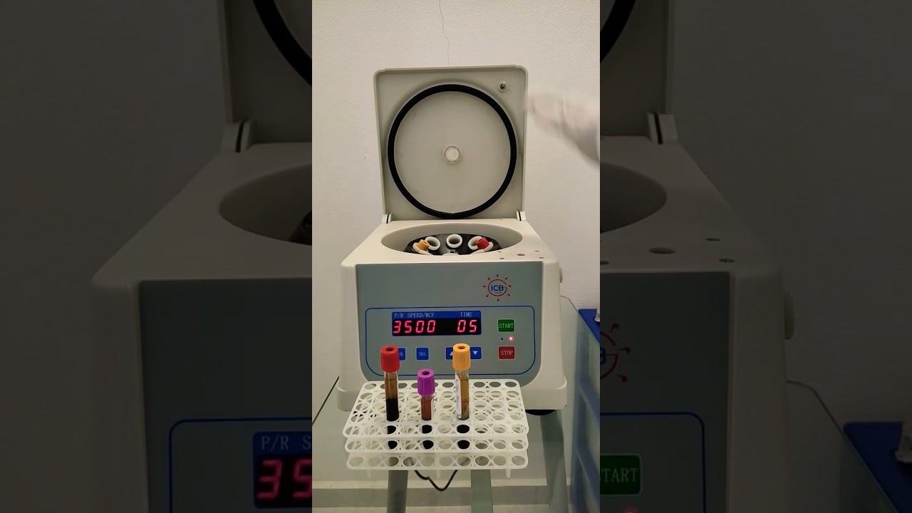 Blood sample tube centrifuge for laboratory testing 🧪🔬🧫