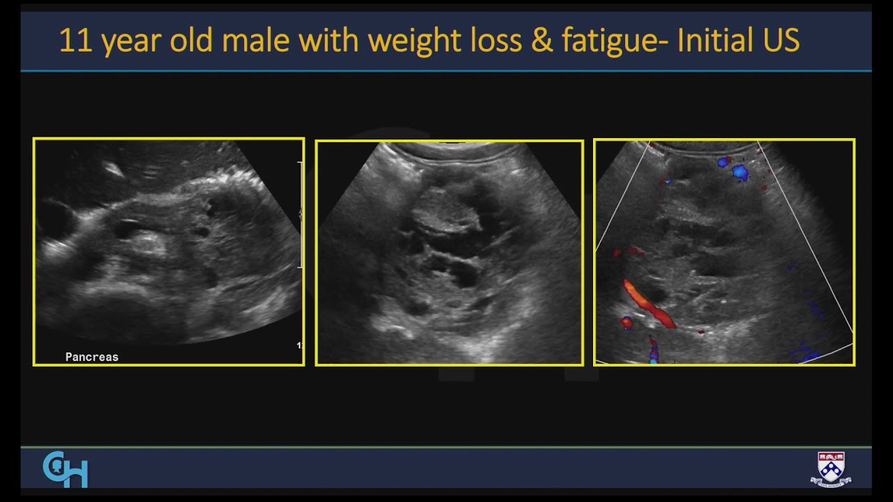 2021 Pediatric Imaging Essentials: Techniques, Pearls and Pitfalls - A CME Video Activity