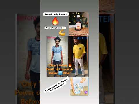 1 Month Me Badla Life ๐ช | Forever Living Products Ka Asar Dekho | Real Result ๐ฅ#brand #power powe