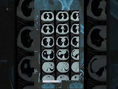 New asset pack / graphics / design / photoshop / png / x rays
