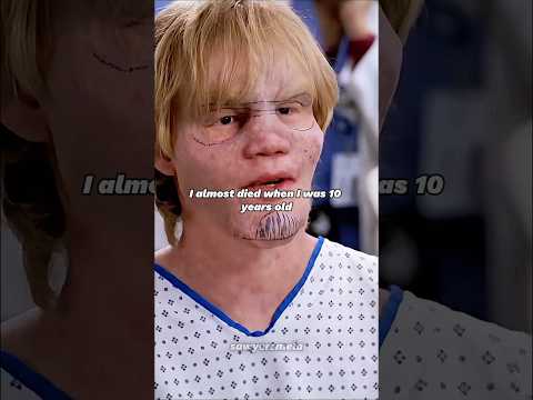 The boy risked his life just to become handsome because his face had caused him so much pain.