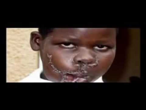 Introduction to Hope Ward - YouTube