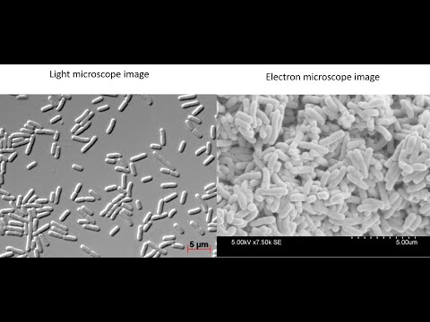 What do bacteria look like under a light vs electron microscope?