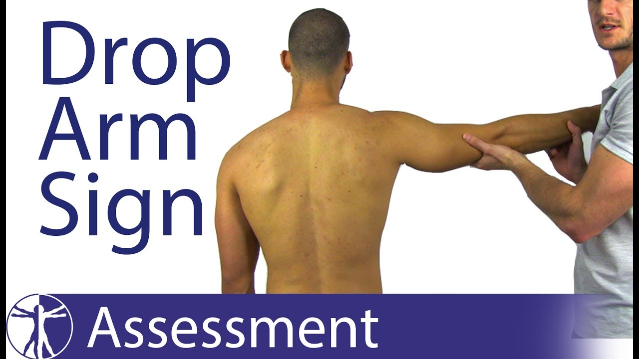 Drop Arm Test / Sign | Supraspinatus Tear