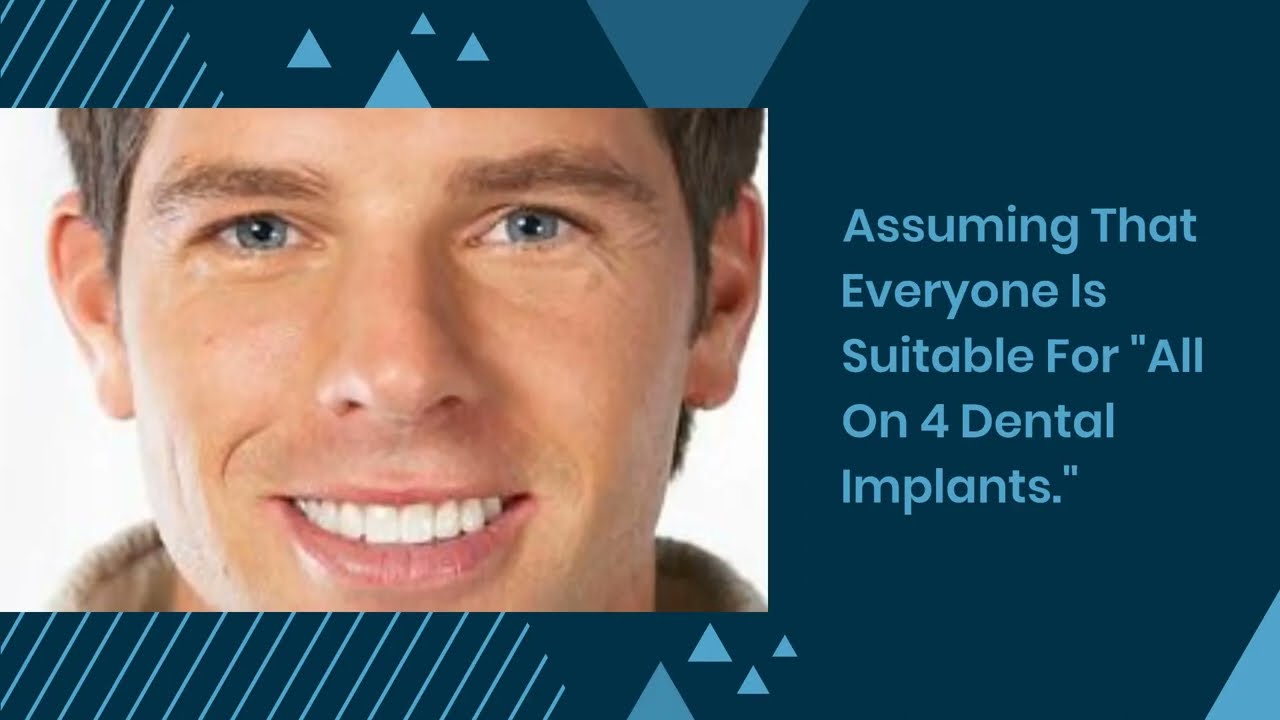Avoid These Mistakes When Choosing All on 4 implants