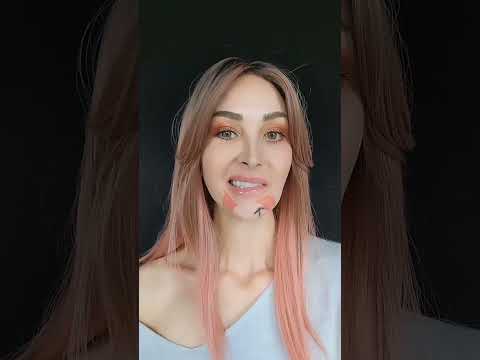 Crooked Smile After Botox