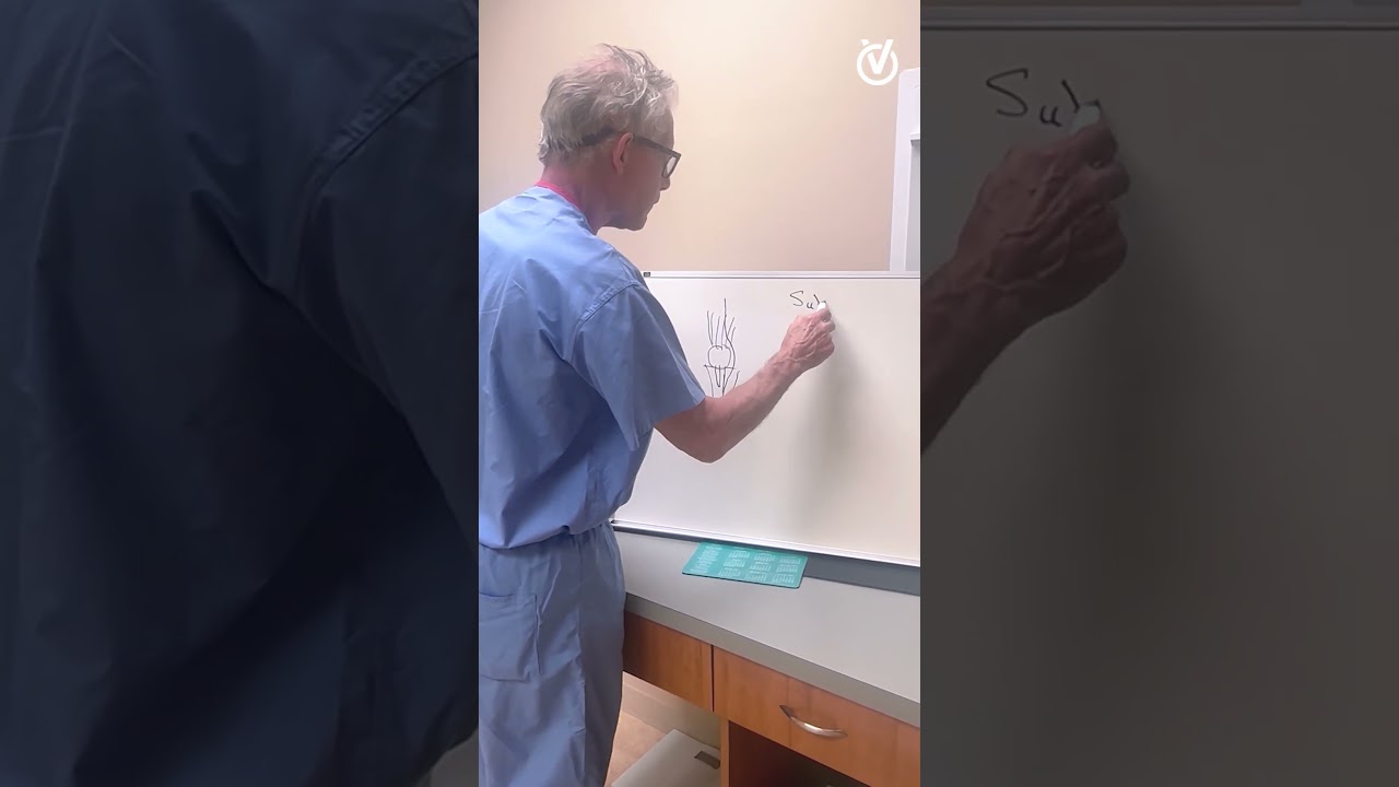 Subvastus Approach to Knee Replacement | Dr. William Nordt