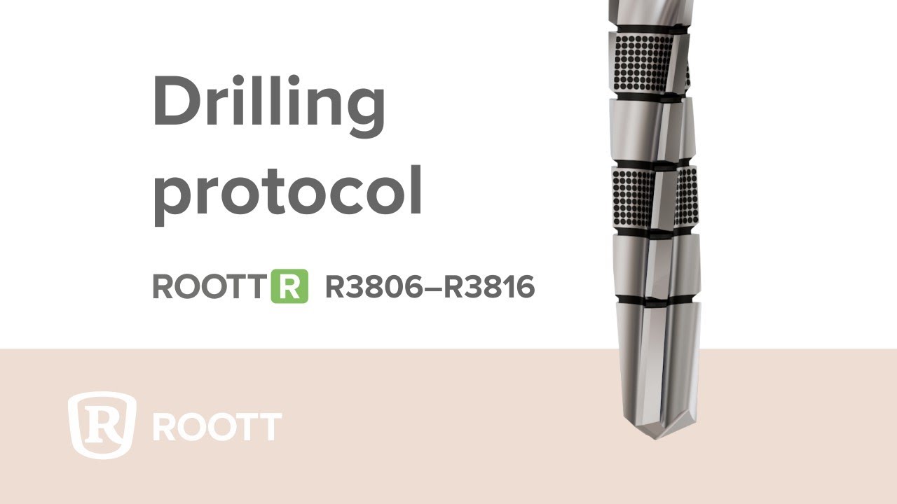 Drilling protocol for ROOTT R R38XX