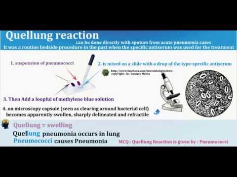 neetpg - MCQ1-Microbiology-quellung reaction