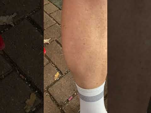 Calf Muscle Twitching and Rippling - Boss post ride