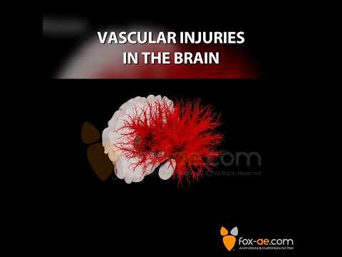 Vascular Injuries in the Brain