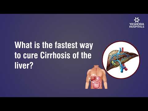 What is the fastest way to cure Cirrhosis of the liver?