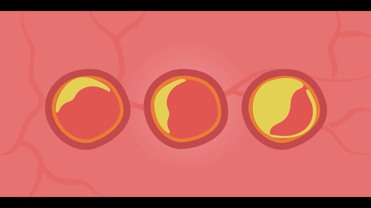 Lipodystrophy on the Inside