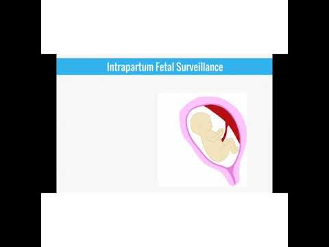 #Intrapartum fetal monitoring #everything #explained.