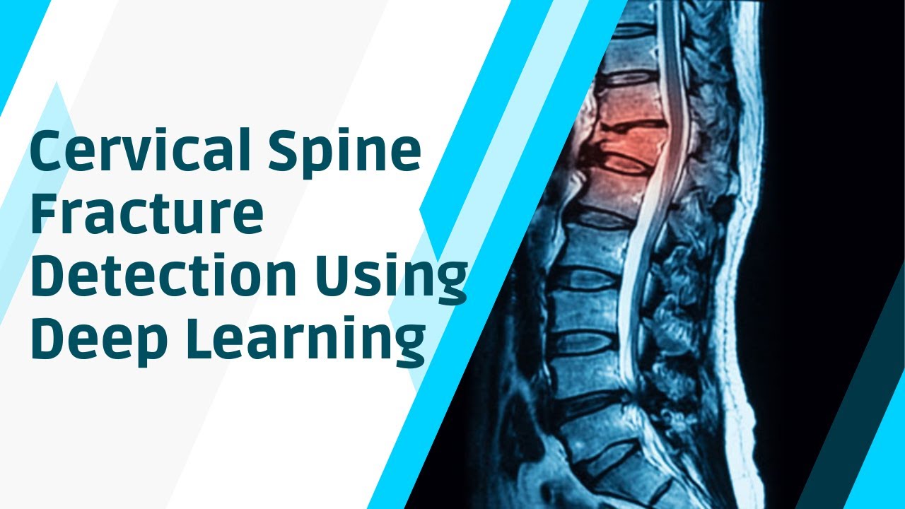 AE083 | Cervical Spine Fracture Detection Using Deep Learning