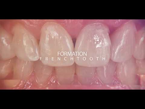 FRENCH TOOTH, la plateforme de formation pour les chirurgiens-dentistes !