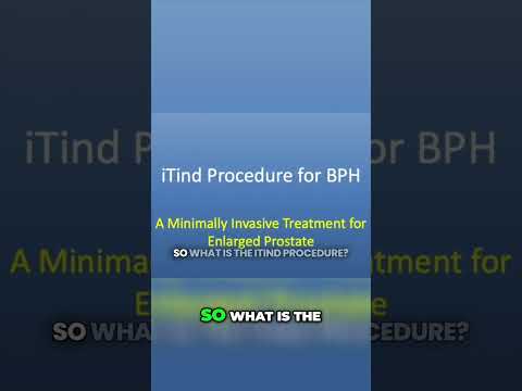 iTind: Revolutionary Treatment for Urinary Issues