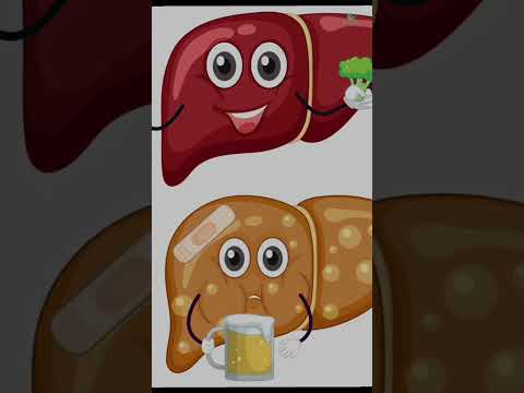Fatty liver 🍺🥂🫀 #fattyliver #hepatitis #cirrhosis #healthtips #nafl #nash