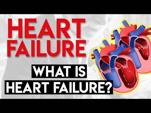 Understanding Heart Failure: An Overview of Causes, Types, and ...