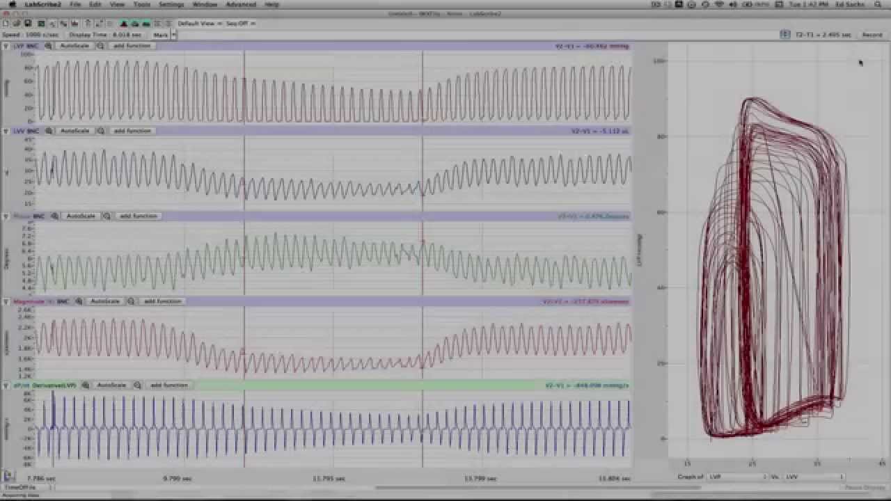 LabScribe Data Acquisition Software - iWorx Systems, Inc.