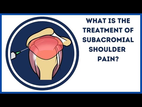 What is the treatment of subacromial shoulder pain