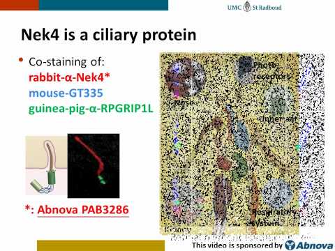 The Ciliopathy-associated Protein Homologs RPGRIP1