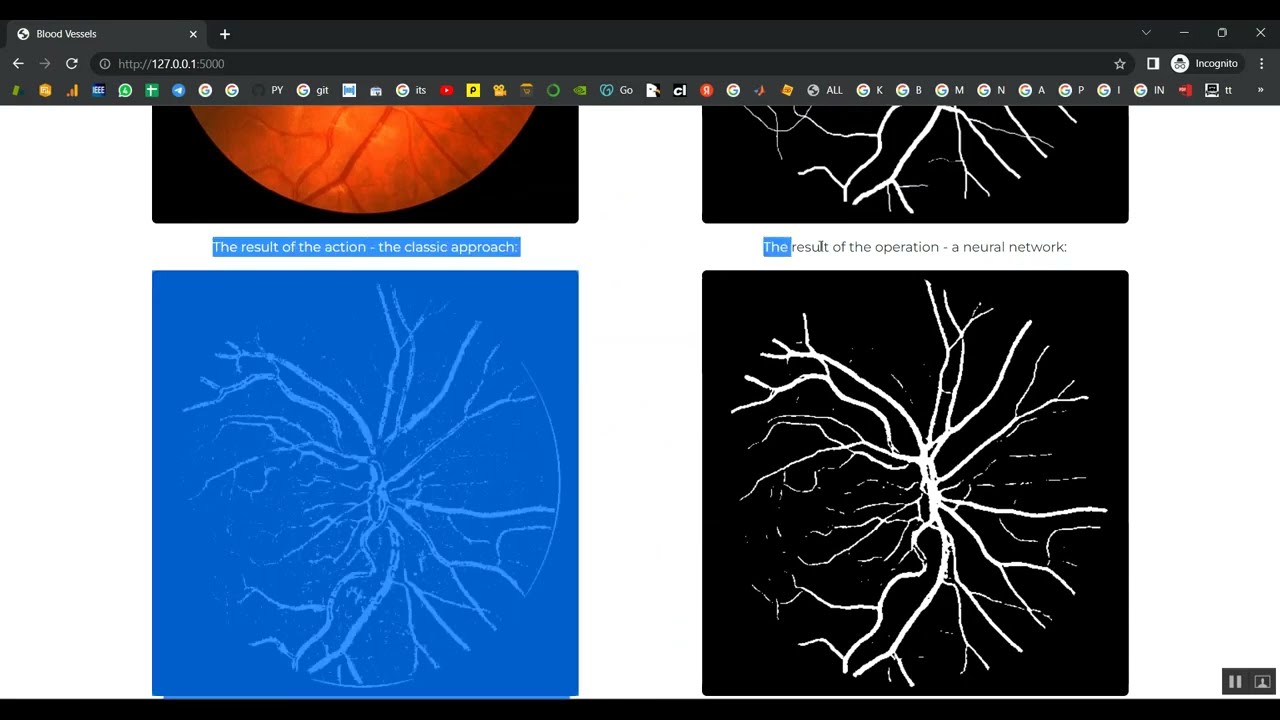 Multi Label Retinal Disease Classification Using Transformers - OKOK ...