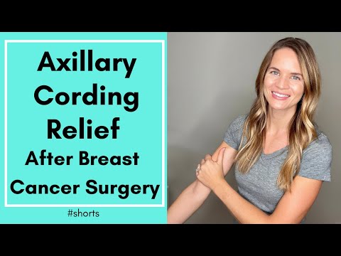 Axillary Cording after Breast Cancer Surgery Treatment Options