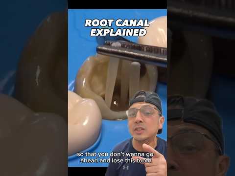How to Save a Tooth with a MASSIVE Cavity? Root Canal and Dental Crown | View Mobile Dental #shorts