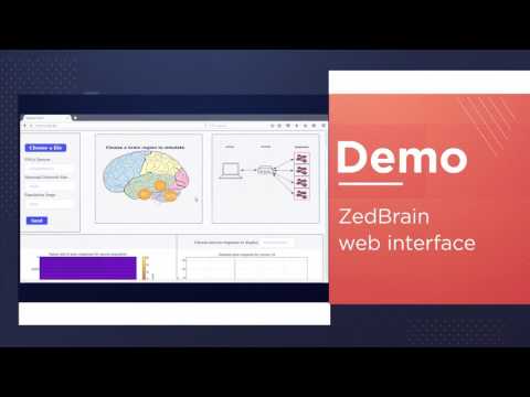 ZedBrain