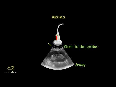 Point-of-care ultrasound (POCUS) Imaging modes and orientation for beginners I Dr. Koratala @NephroP