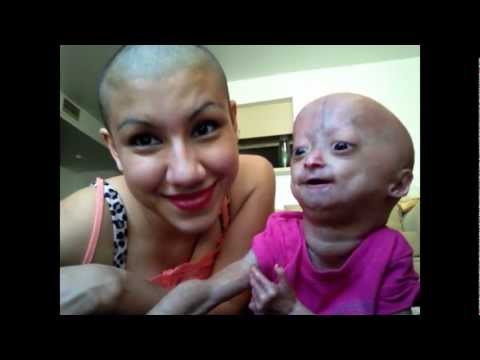 Twins - Adalia Rose (Official)