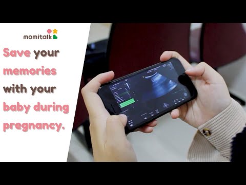 Meet your baby in the ultrasound video from your smartphone!๐ฒ- For all expecting moms, in Indonesia๐คฐ