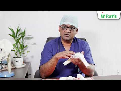 Why Patients Prefer Robotic Knee Replacement Surgery: Dr. Atul Mishra Explains