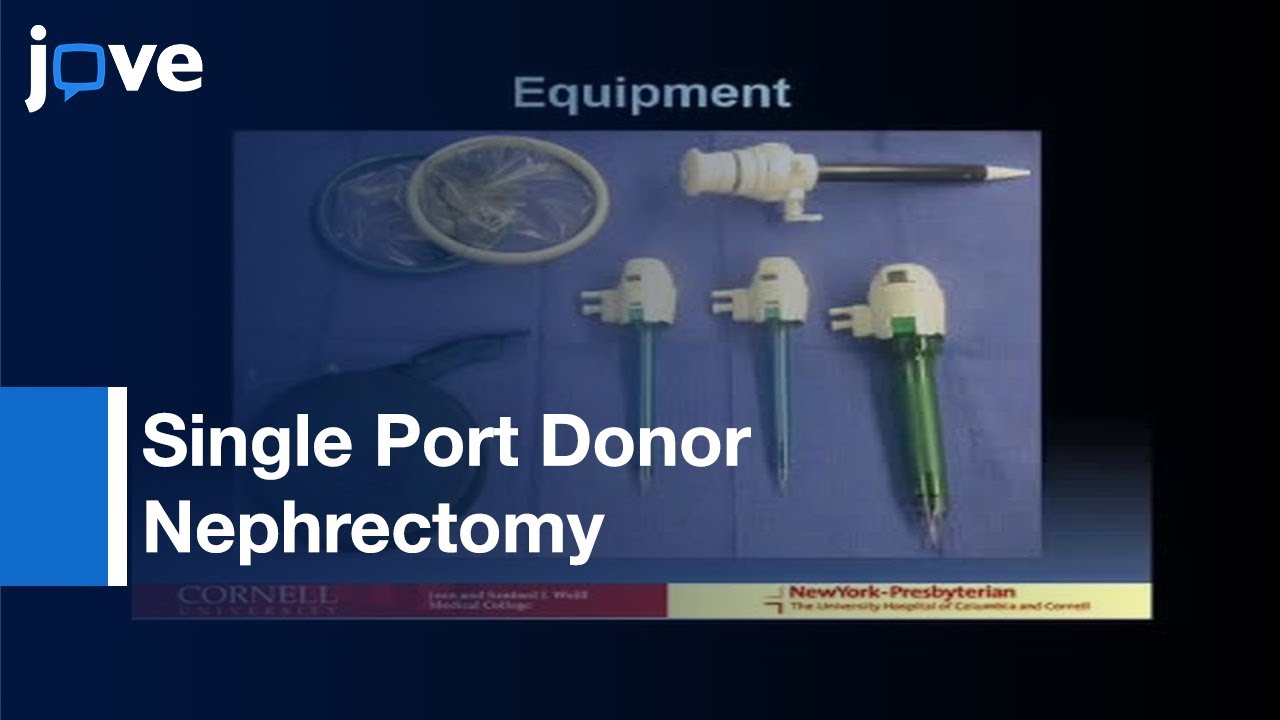 Single Port Donor Nephrectomy