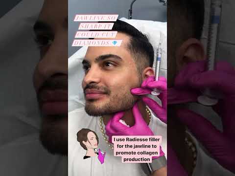 JAWLINE FILLER FOR MEN!