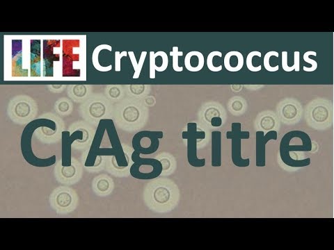 Interpreting CrAg titres